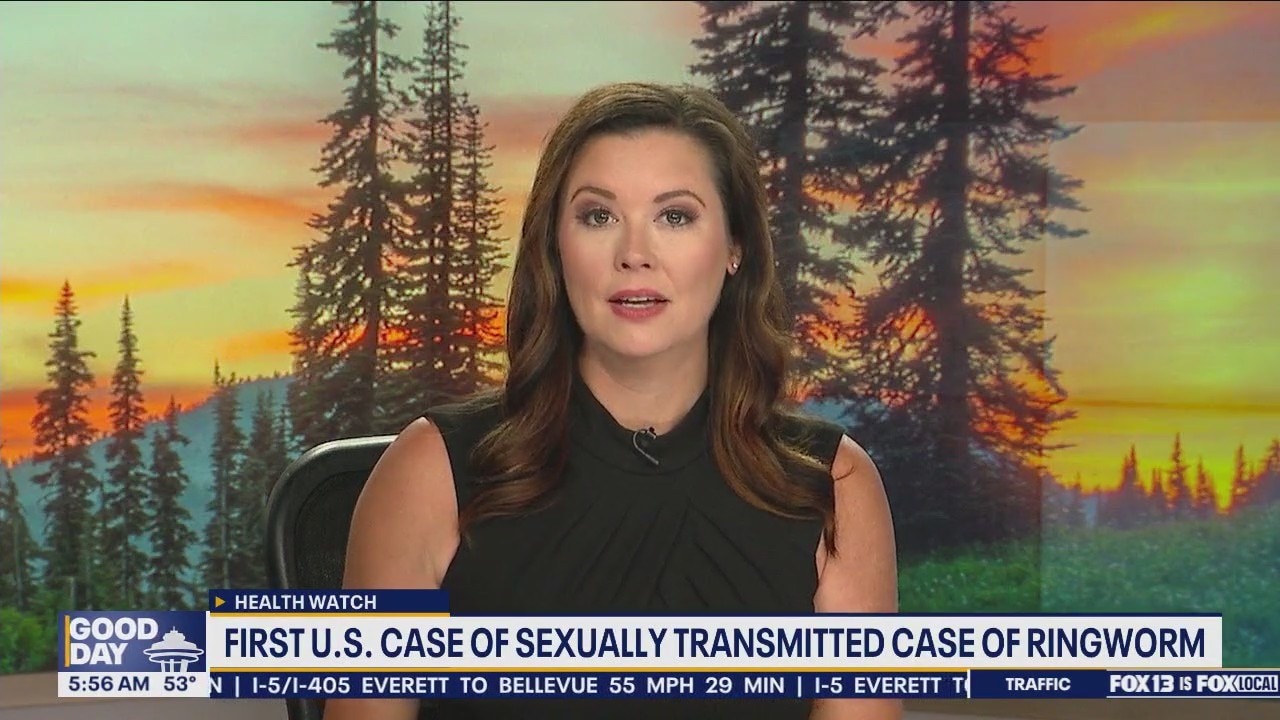 First U.S. case of sexually transmitted ringworm | FOX 13 Seattle
